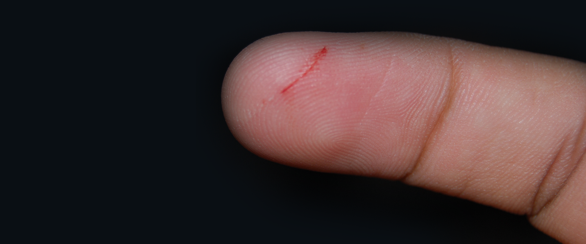 It's Like a Paper Cut - Your Life Is Now